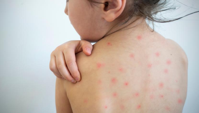 Preventing Skin Problems And Spotting The Warning Signs - A Complete ...